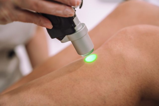 Epilation Laser à Limoges : à partir de quel âge commencer